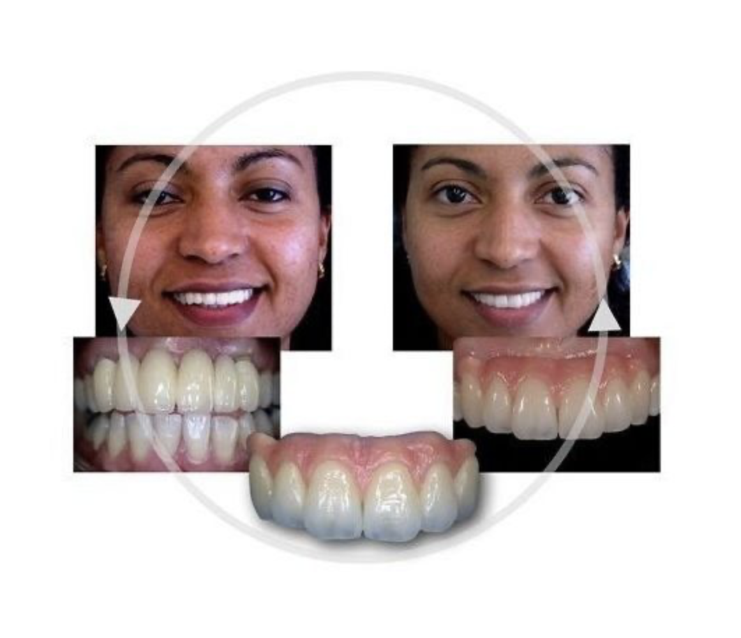 Digital Smile Design Test | See Your New Smile